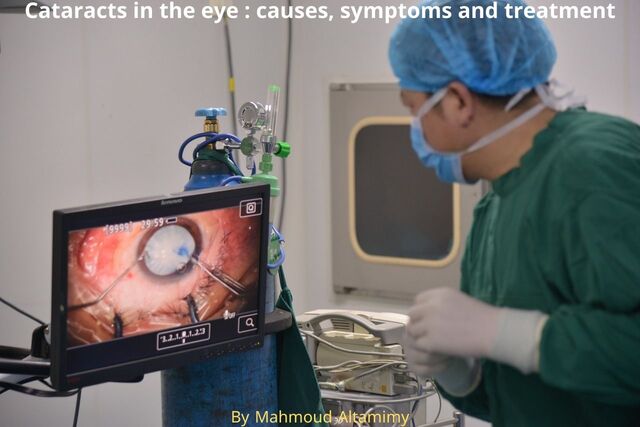 Cataracts in the Eye: Causes, Symptoms, and… [PDF/iPad/Kindle]